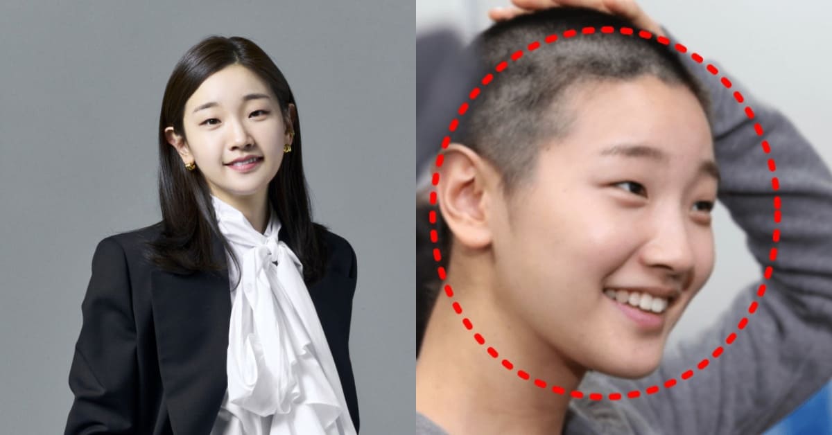 “암 투병 후 복귀했지만 또 ” 박소담 충격적인 투병 생활 내용